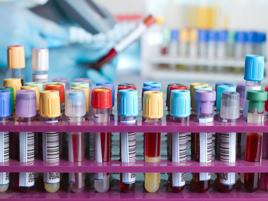 Bedside Lab Labeling Without Errors - The ISG